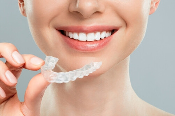 The Choice: Angel Aligner vs Invisalign | Balmoral Dental Centre