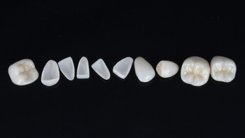Understanding Tooth Crown Pain: Relief and Treatment Options