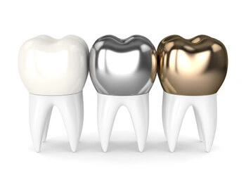 The Symptoms of Loose Dental Implant Crown: Key Insights